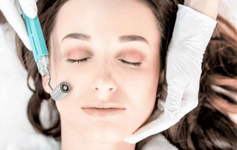 Microneedling for Acne Scars: Effectiveness, Side Effects, and Costs ...